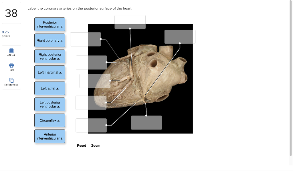 Solved Label the coronary arteries on the posterior surface | Chegg.com