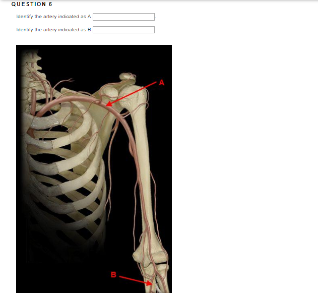 Solved QUESTION 1 Identify the artery indicated as A | Chegg.com