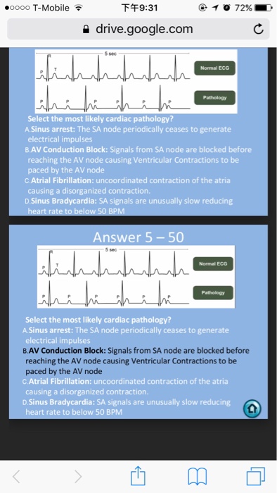 Solved Physiology question about ECG. Can any one help me | Chegg.com