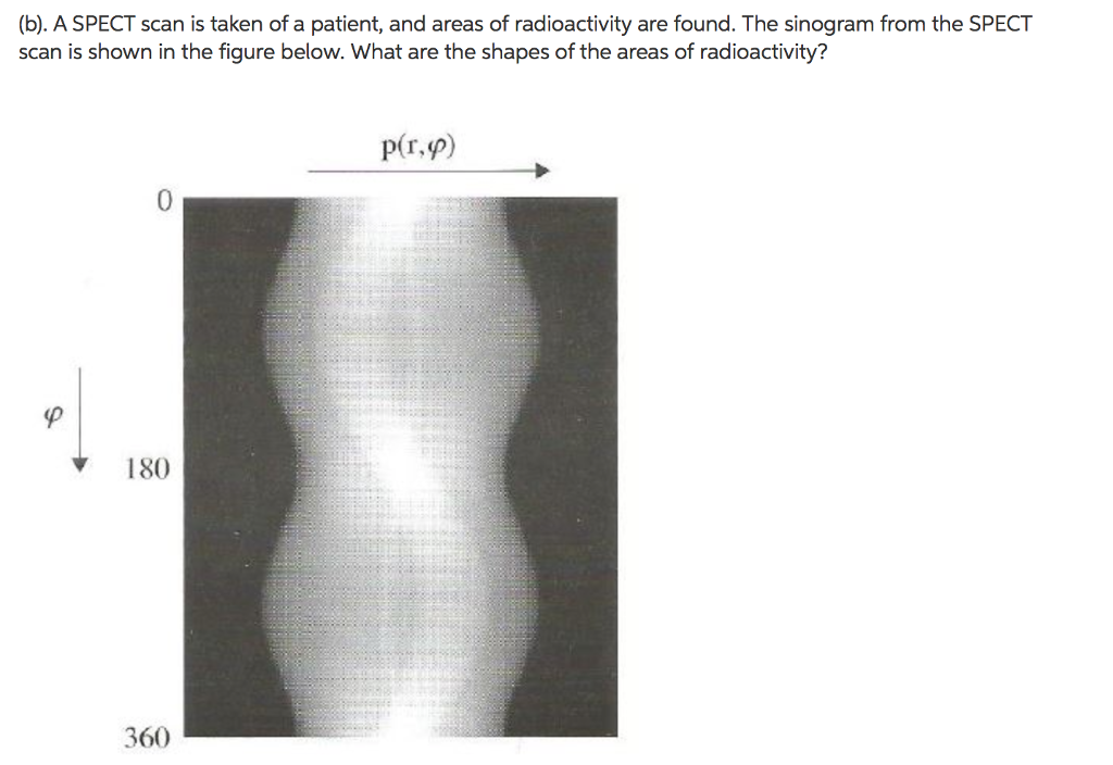 Solved A SPECT scan is taken of a patient, and areas of | Chegg.com