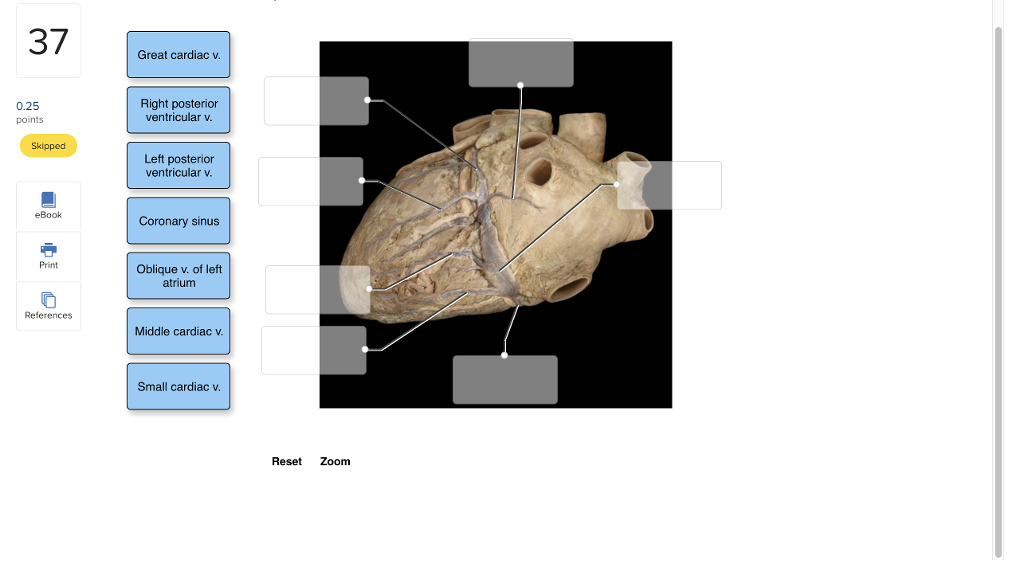 Solved Label the cardiac veins on the posterior surface of | Chegg.com